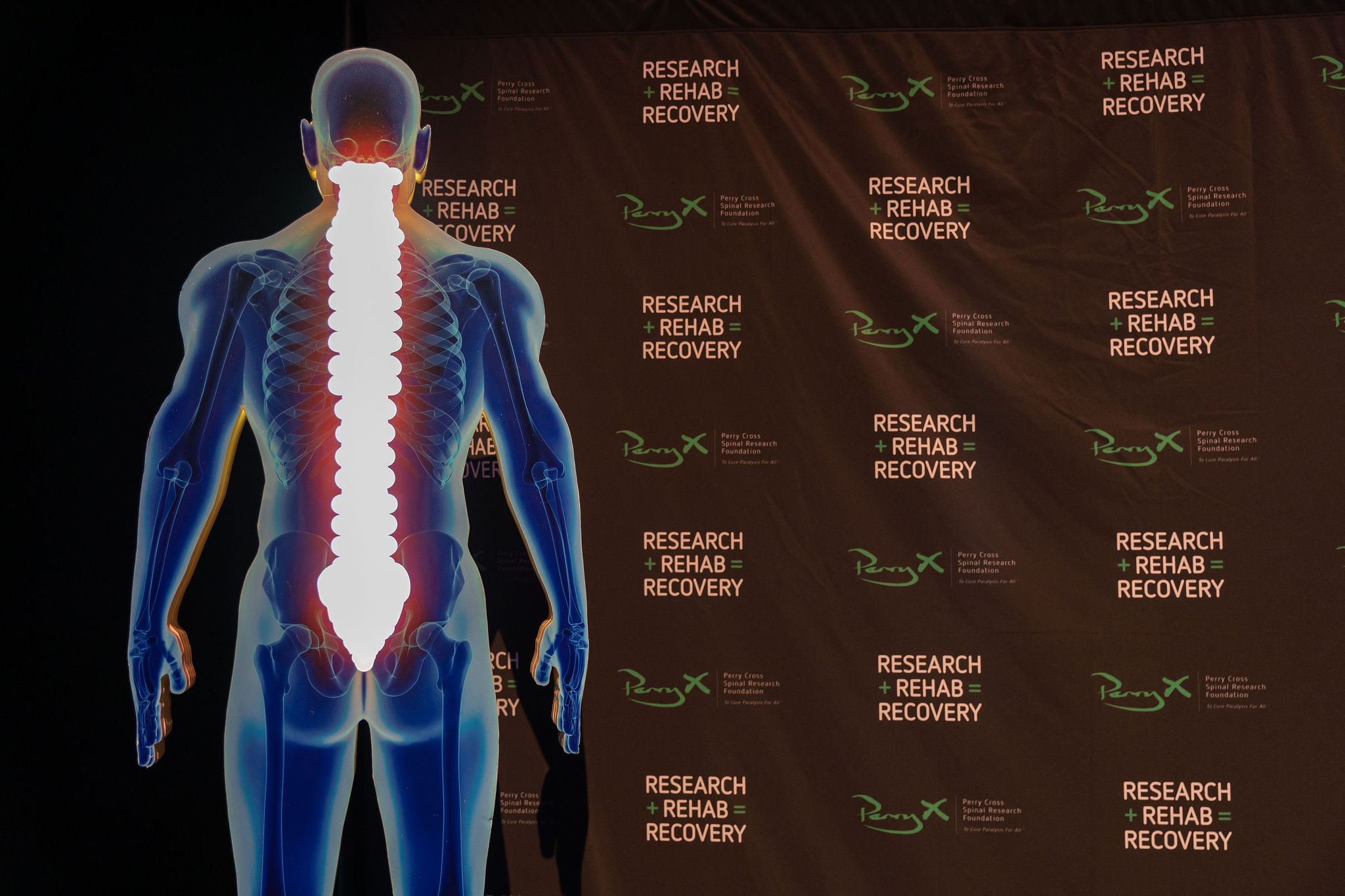 Thankyou Celebration | PCSRF | To Cure Paralysis for All