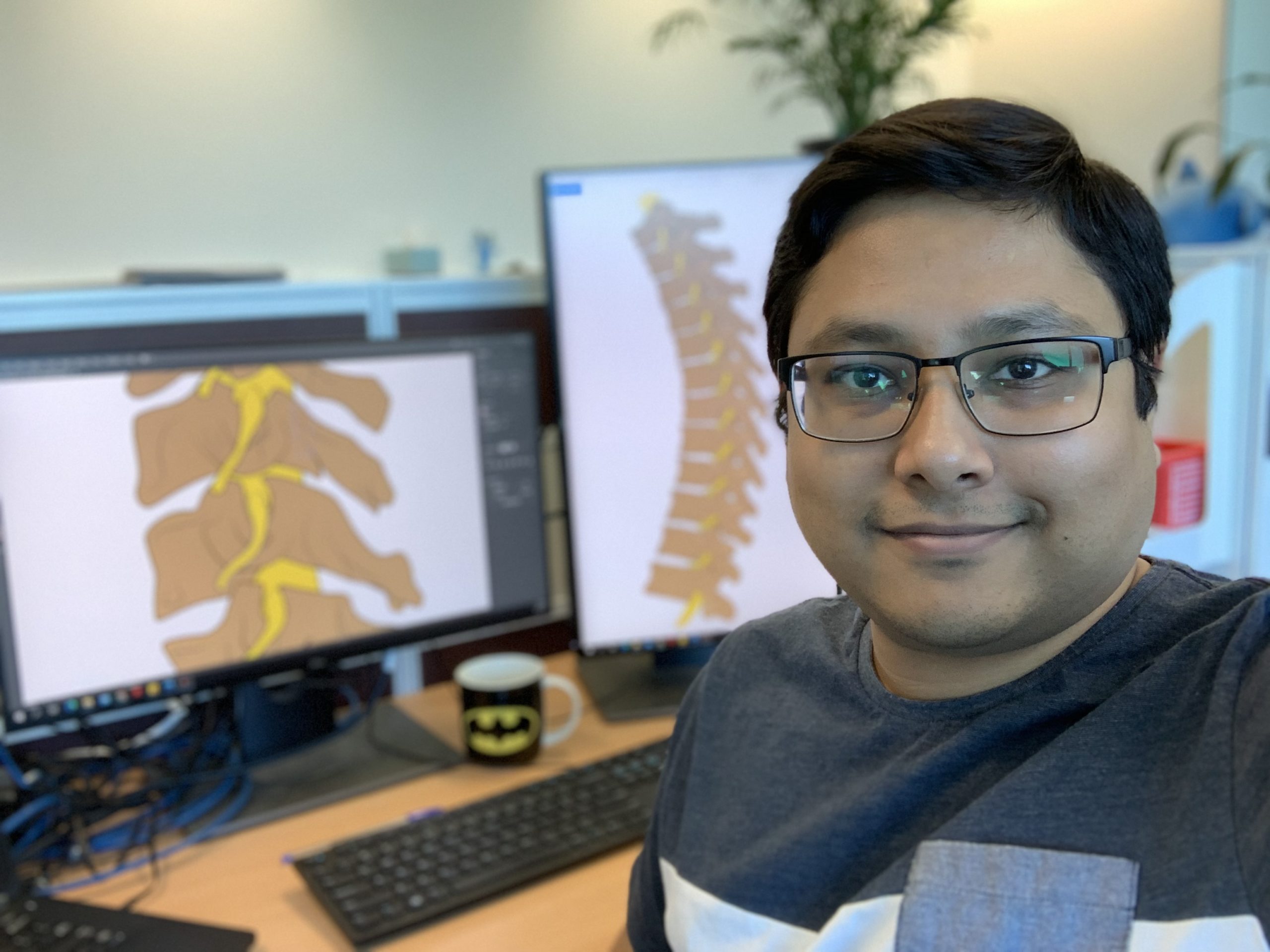 In pursuit of a cure | PCSRF | To Cure Paralysis for All